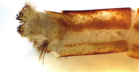 Female Genitalia In Lateral View Download Scientific Diagram