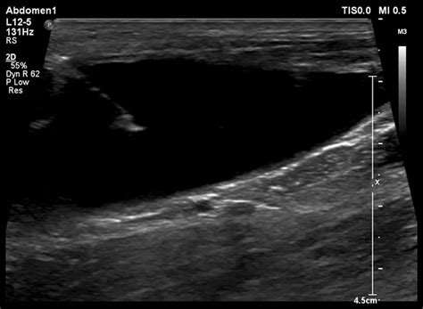 Performing Cystocentesis In Dogs And Cats Clinicians Brief