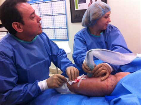 Sclerotherapy Varicose Vein Treatment Center Chicago Vein Care Center