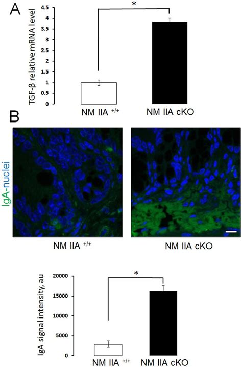 Loss Of Nm Iia In The Intestinal Epithelium Results In The Increase Of