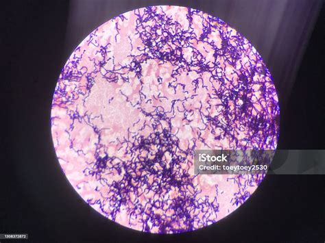 그램 얼룩에 박테리아 세포 0명에 대한 스톡 사진 및 기타 이미지 0명 3차원 형태 건강관리와 의술 Istock