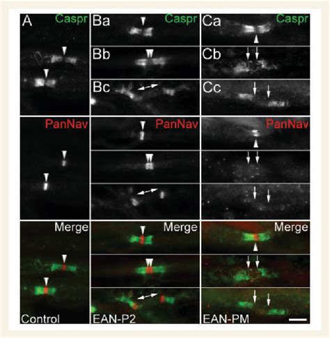 Figure 1 From Disruption Of Neurofascin And Gliomedin At Nodes Of Ranvier Precedes Demyelination