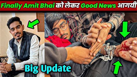 Crazy Xyz Amit Bhai Cobra Snake Bite Update 😱 Crazyxyz Youtube