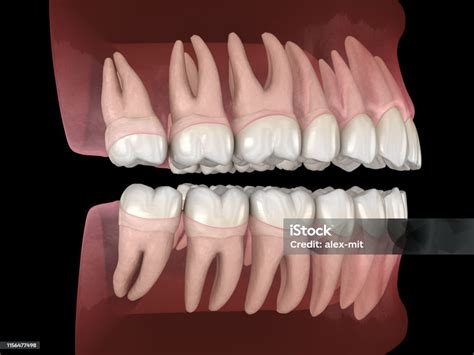 하악및 상악인간 잇몸과 치아의 형태학 의학적으로 정확한 치아 3d 일러스트레이션 이빨에 대한 스톡 사진 및 기타 이미지 이빨 형태학 개과 Istock