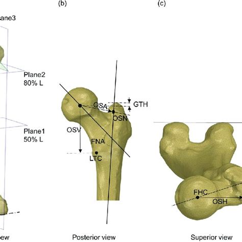 Schematic Drawing Illustrating The Measured Morphological Parameters Of Download Scientific
