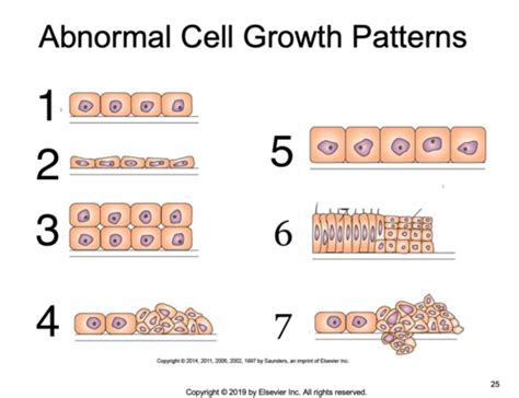 Pathophysiology Chapter 1 Flashcards Quizlet