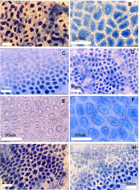 Mycelium Observed In Festuca And Lolium Seeds By Microscope A L