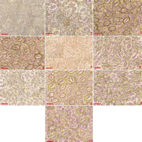 Leaf Morphology Of Olive Varieties Download Scientific Diagram
