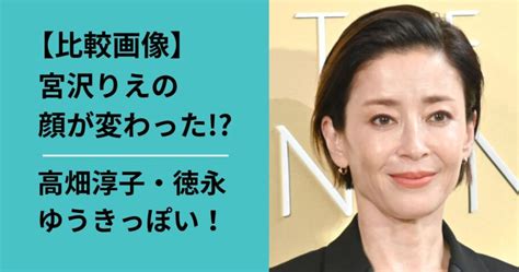 【比較画像】宮沢りえの顔が変わった！？似てる女優は高畑淳子？徳永ゆうきも？