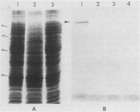 Detection Of Heme Binding Proteins In S Flexneri Cells Were Allowed