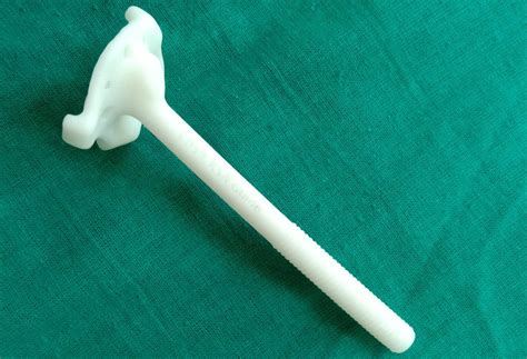 Reverse Shoulder Arthroplasty With 3d Printed Solutions Jajal Medical