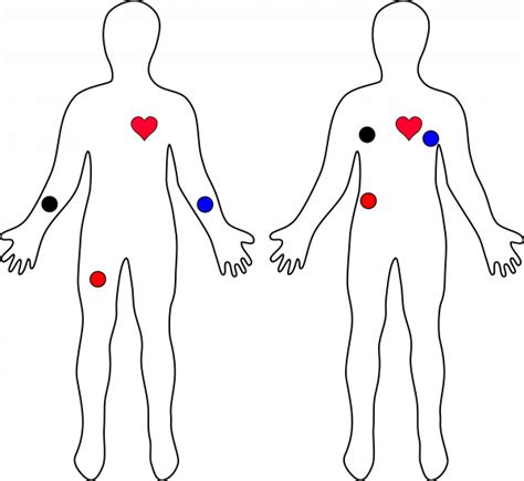 Ad Heart Rate Monitor Hookup Guide Sparkfun Learn