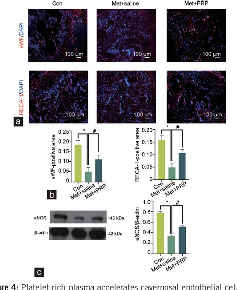 Figure 4 From Repeated Platelet Rich Plasma Injections Improve Erectile Dysfunction In A Rat