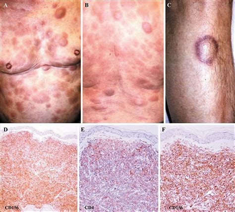 JLE European Journal Of Dermatology SQUIZ Your Knowledge Rapidly