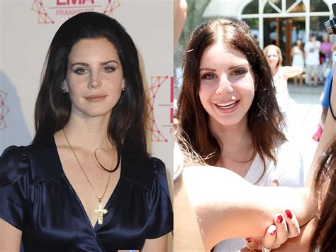 Alerte Chirurgie Esthétique Lana Del Rey Sest Elle Refait Le Nez