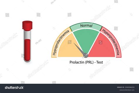 Prolactin Hormone Prolactin Blood Test Prolactinoma Stock Vector
