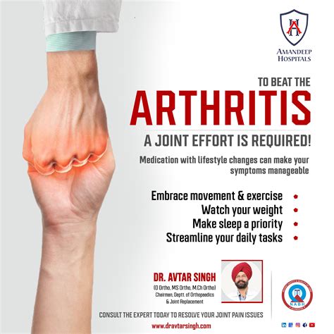 Arthritis Symptoms Artofit