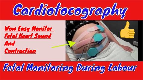 Cardiotocography Medical Discovery Youtube