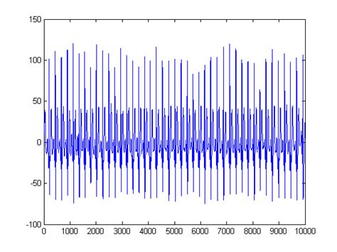 Detection Of Qrs Complexes In Ecg Signals Based On Empirical Mode