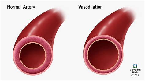 Cannabis Is A Vasodilator