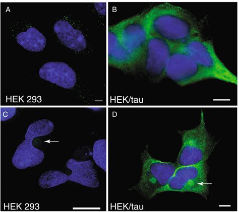 Proteasome Inhibition Drives Aggresome Formation In Tau Overexpressing