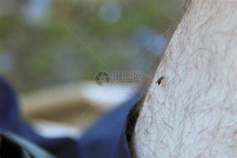 满是血的蚊子咬在人腿上高清图片下载 正版图片505766803 摄图网