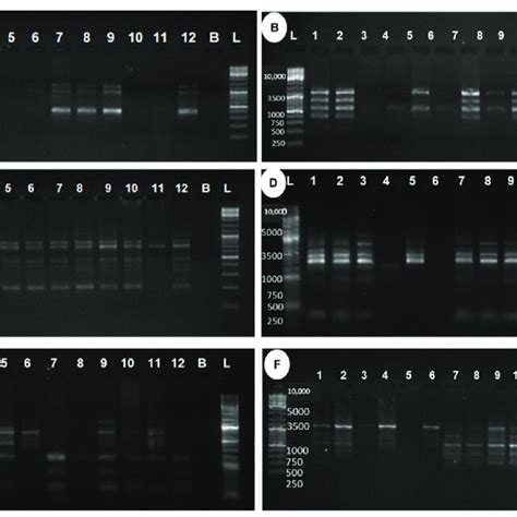 Random Amplified Polymorphic Dna Rapd Polymorphism In Download