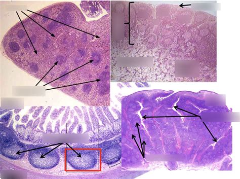 Lab Exam Histology Of The Lymphatic System And Immunity Diagram