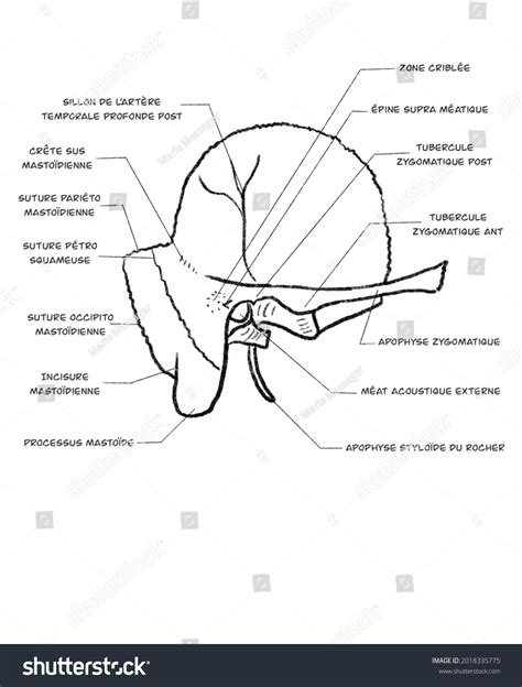 Temporal Bone Labeled