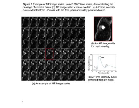Automated Detection Of Left Ventricle In Arterial Input Function Images