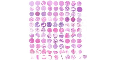 Fda999w6 Current Lot Is Missing 10 Tissue Cores 30 Discount Is