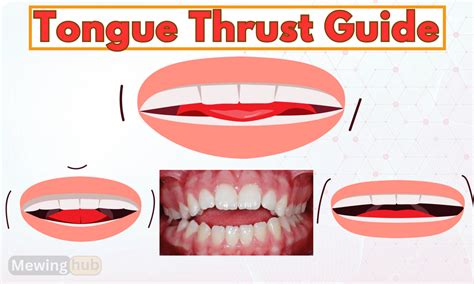Fwhr How To Measure Calculate And Maximize Facial Ratios Mewinghub