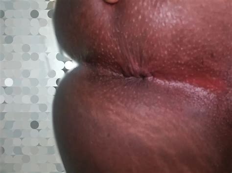 My Hot Shaved Asshole 3 Pics Xhamster