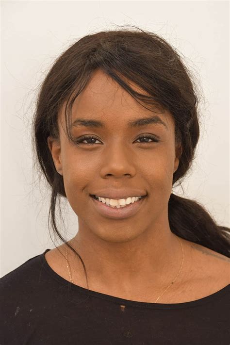 Before And After Jaw Angle Reduction Photos San Francisco
