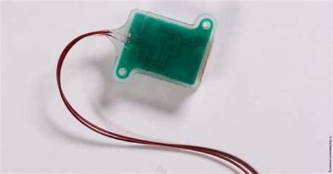 A Wireless Bladder Monitoring Device A Wireless Bladder Monitoring Device