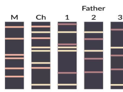Forensic Dna Profiling Pptx