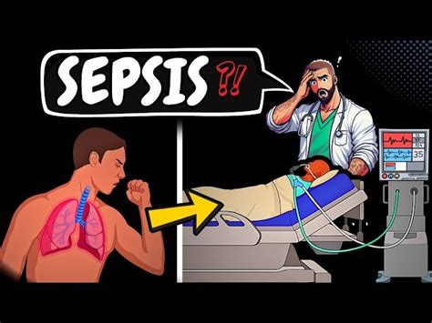 Free Video Understanding Sepsis A Visual Clinical Guide 2024 From