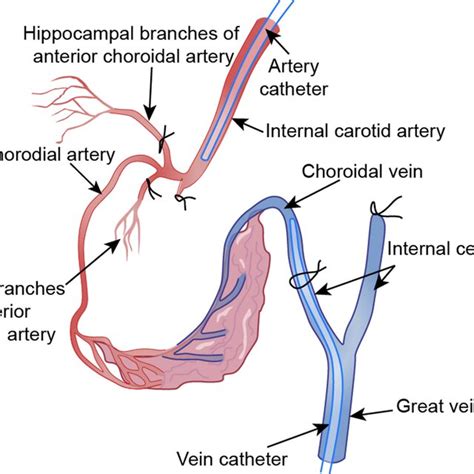 Catheter Placement Method In The Vascular System Of The Choroid Plexus Download Scientific
