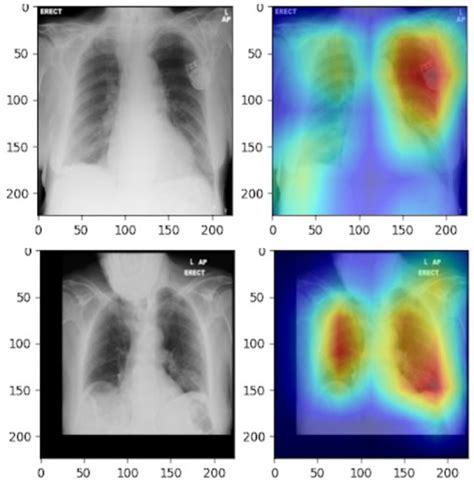 Representation Of Cnn Outputs On A Heat Map Using Grad Cam The