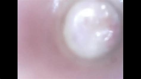 Endoscope Xxx Mobile Porno Videos And Movies Iporntvnet