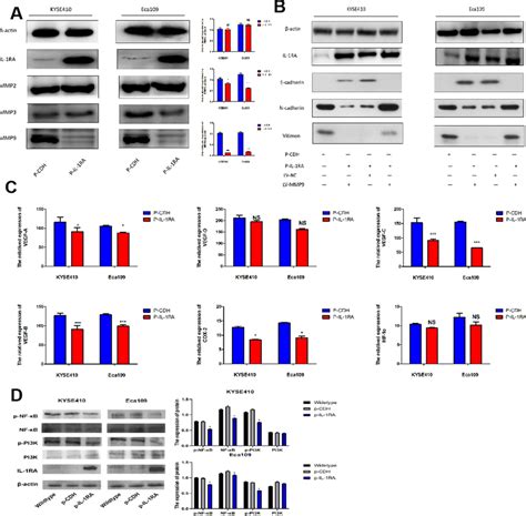 IL 1RA Inhibited EMT Progression Via MMP9 In ESCC Together With The