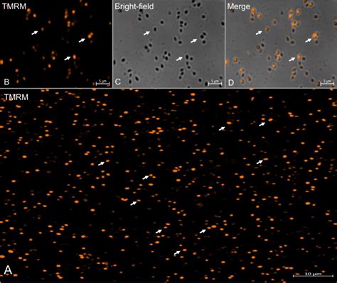 Confocal Imaging Of Tmrm Staining Of Purified P Massiliensis Virions