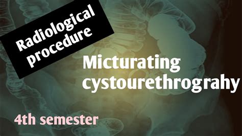 Micturating Cystourethrograhy Mcug Indications Contraindications Procedure Radiology Youtube