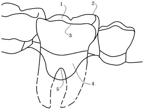 A Method Of 3d Printing Personalized Periodontal Tissue Regeneration Materials Eureka Patsnap