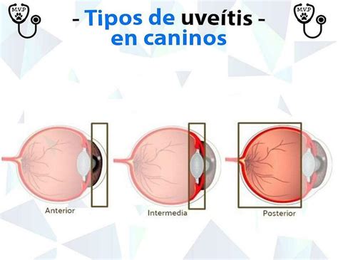 Tipos de uveítis en caninos fraii uDocz