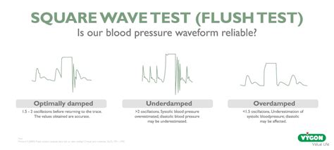 Square Wave Test Flush Test Campus Vygon Global