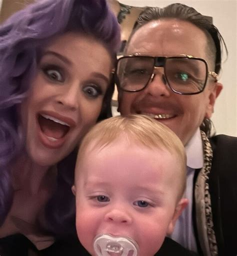 Kelly Osbournes Boyfriend Sid Says His ‘face Melted Off In Update