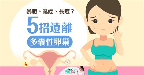 健康321 【5招遠離「多囊性卵巢症候群」】