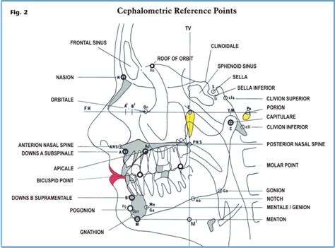 The Bimler Elite Cephalometric Analysis A Valuable Diagnostic Tool For Skeletal Malocclusions