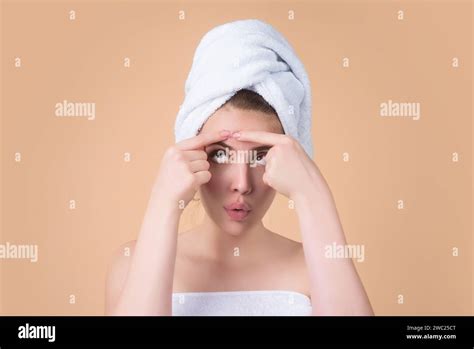 Woman Squeeze Out Pimples On Forehead Acne And Pimple On Skin